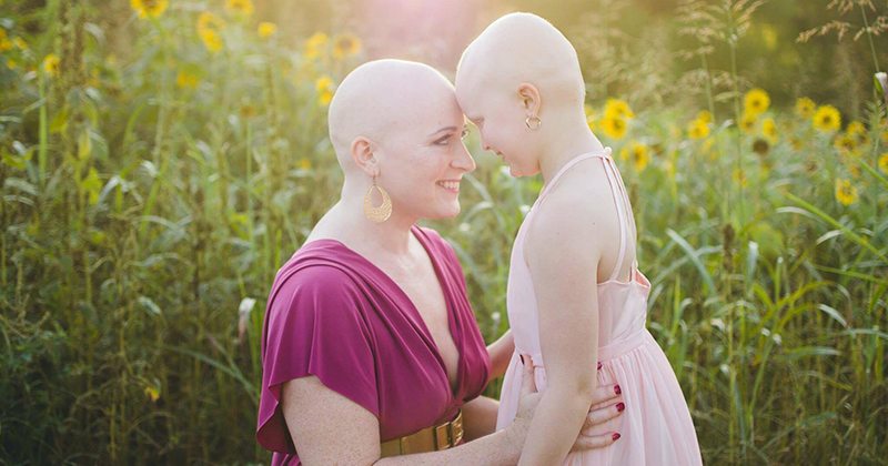 Mom And Daughter Prove That Bald Is Beautiful – HealthZap